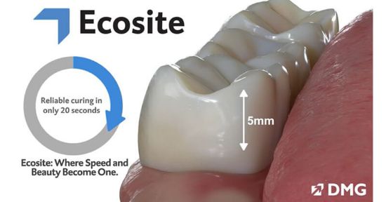 Eldex. Ecosite Bulk Fill, 0.25gm Safetips